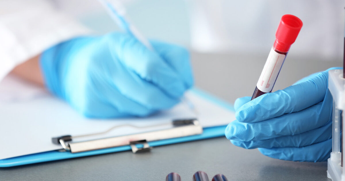 What Lab Tests Do I Need? A Guide to Common… | Schneck Medical Center