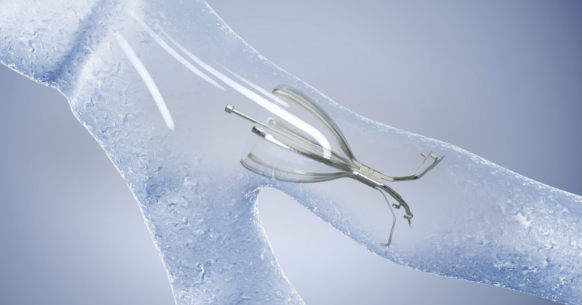 Schneck Pulmonology Offering Advanced… | Schneck Medical Center