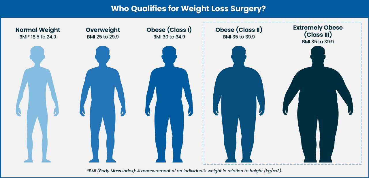 Bariatric Weight Loss Surgery | Schneck Medical Center
